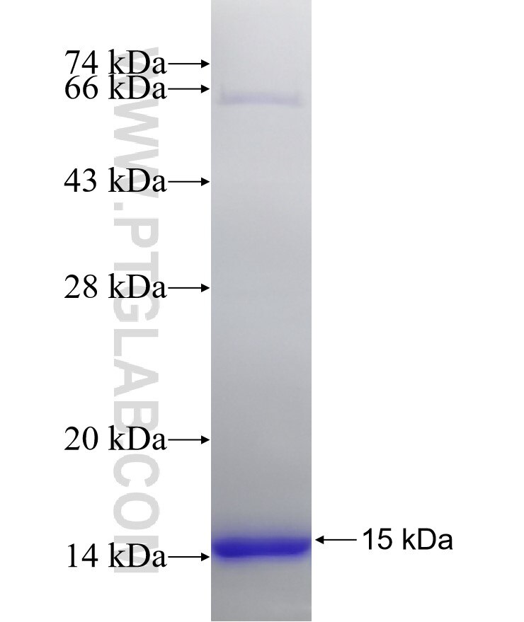 TEAD1 Fusion Protein Ag32187 | Proteintech