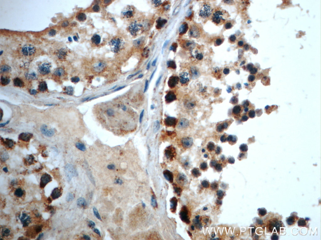 TFAM antibody (22586-1-AP) | Proteintech