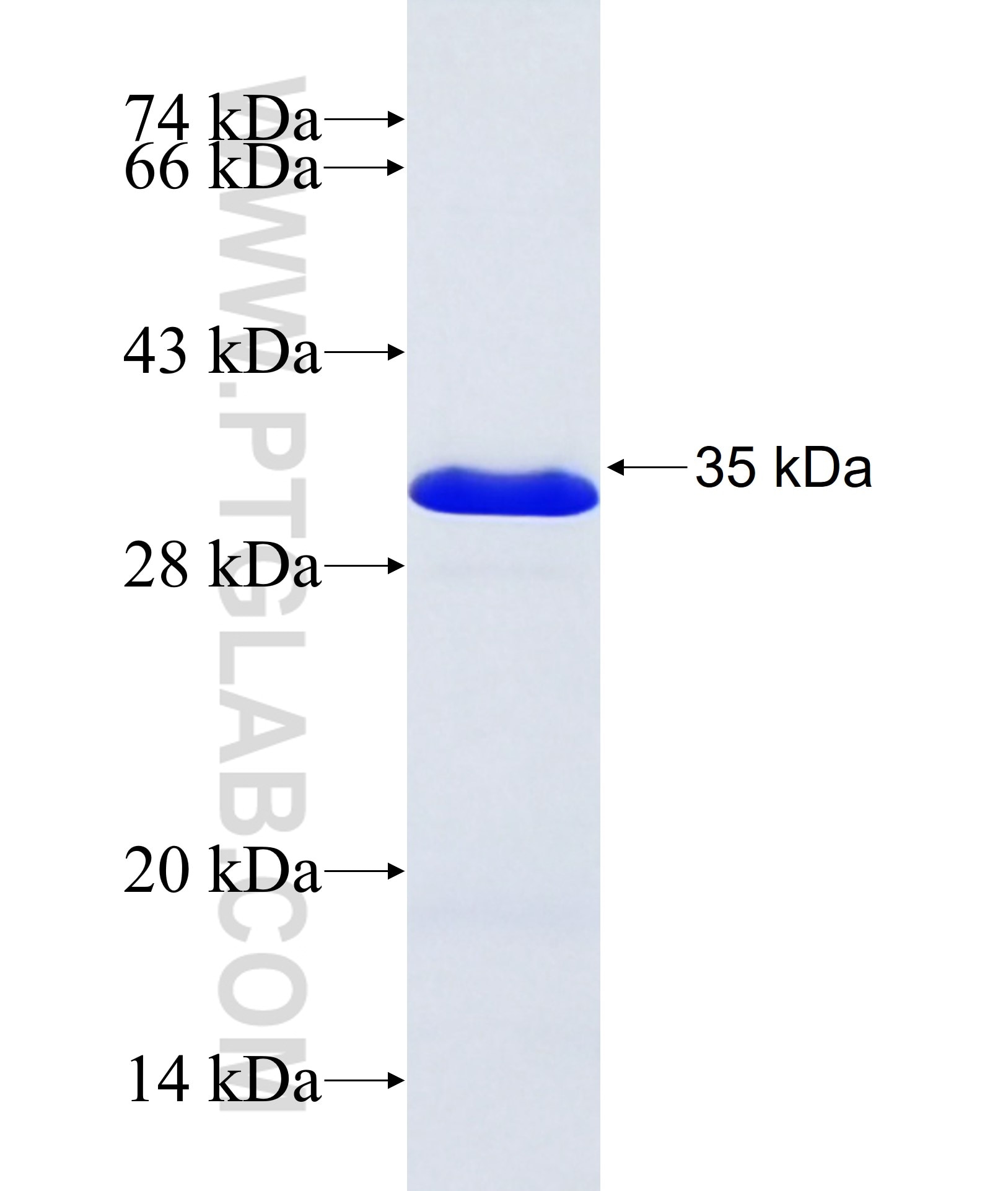 TFE3 Fusion Protein Ag38080 | Proteintech
