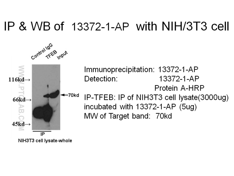 TFEB Fusion Protein Ag4194 | Proteintech
