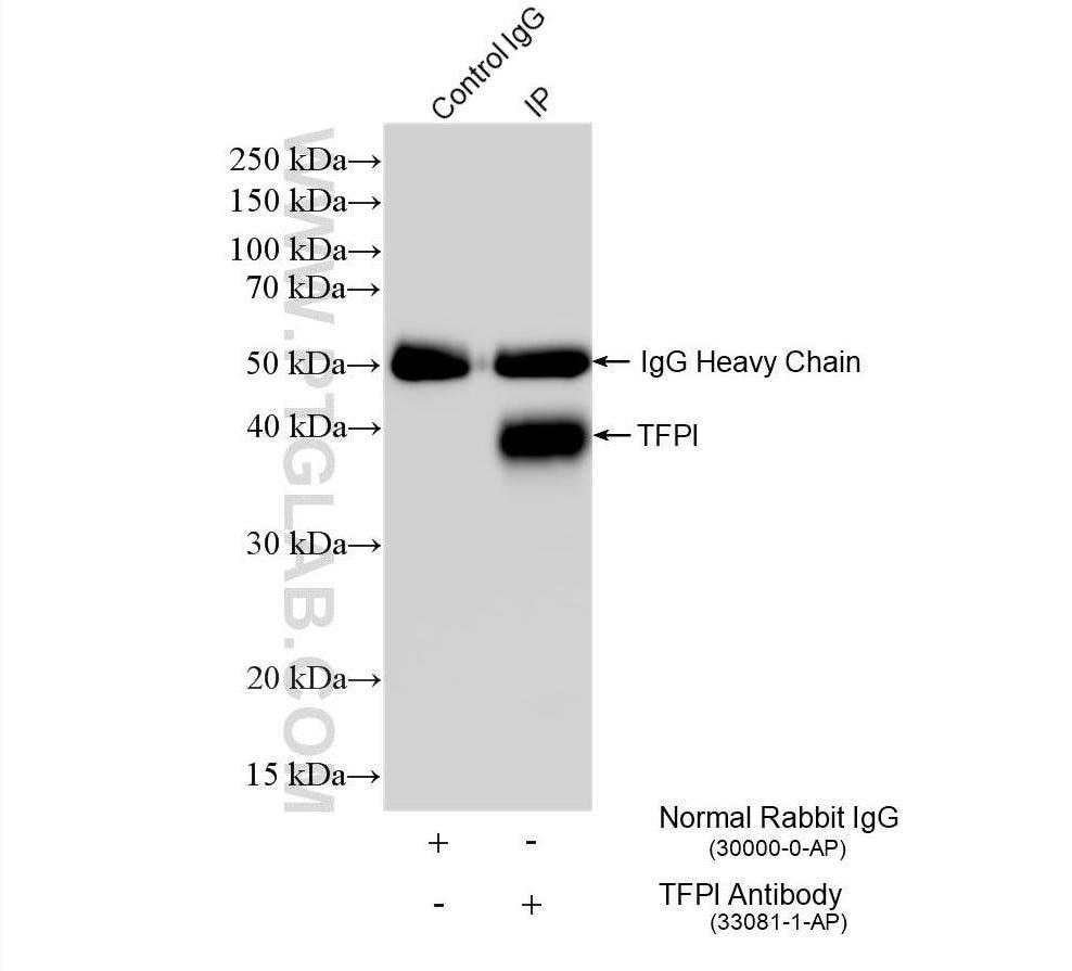 TFPI antibody (33081-1-AP) | Proteintech