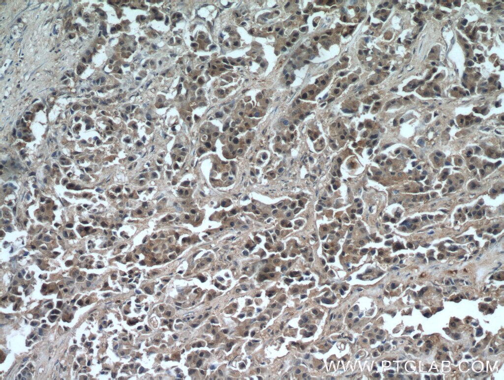 CD71 Fusion Protein Ag0123 | Proteintech