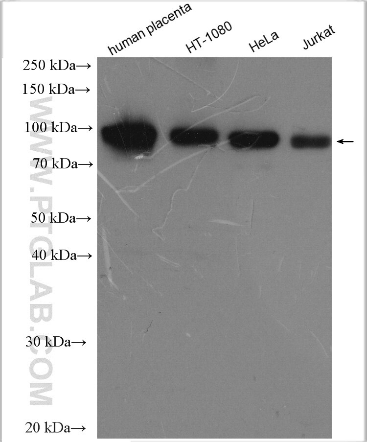 CD71 antibody (10084-2-AP) | Proteintech