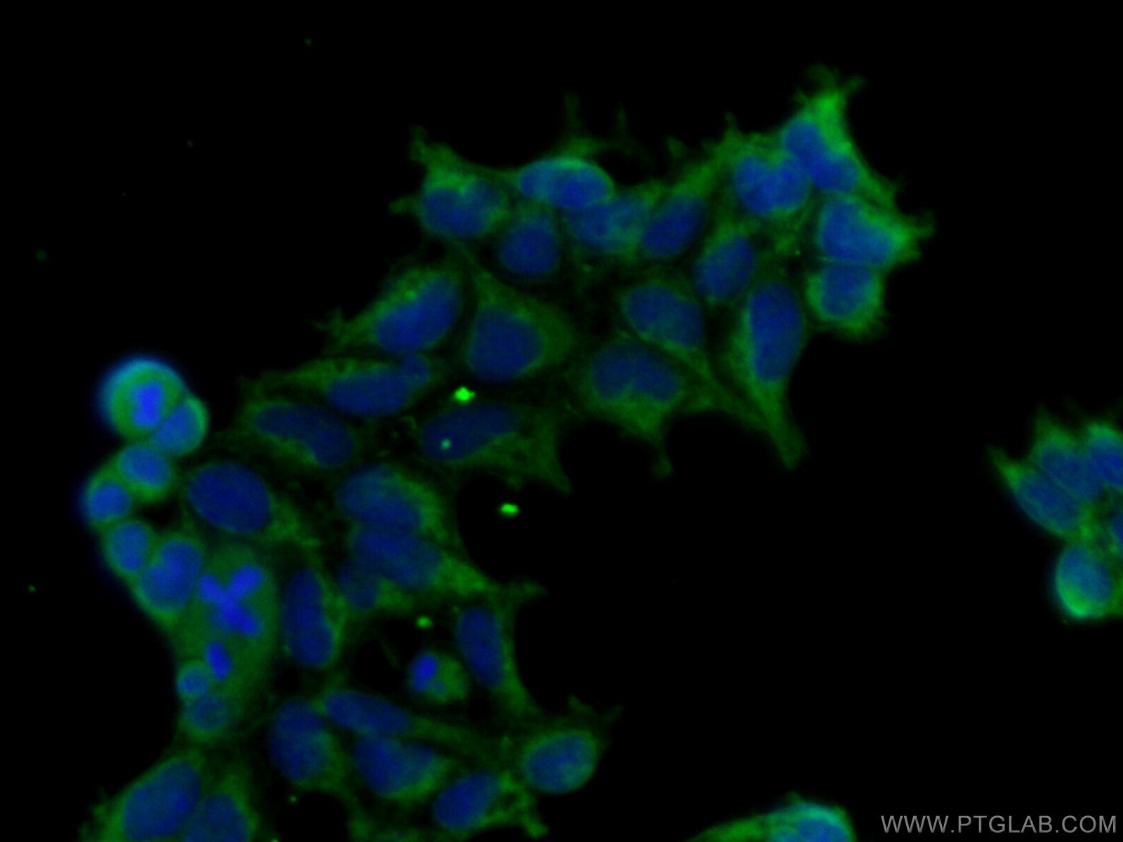 TGF Beta 1 antibody (21898-1-AP) | Proteintech