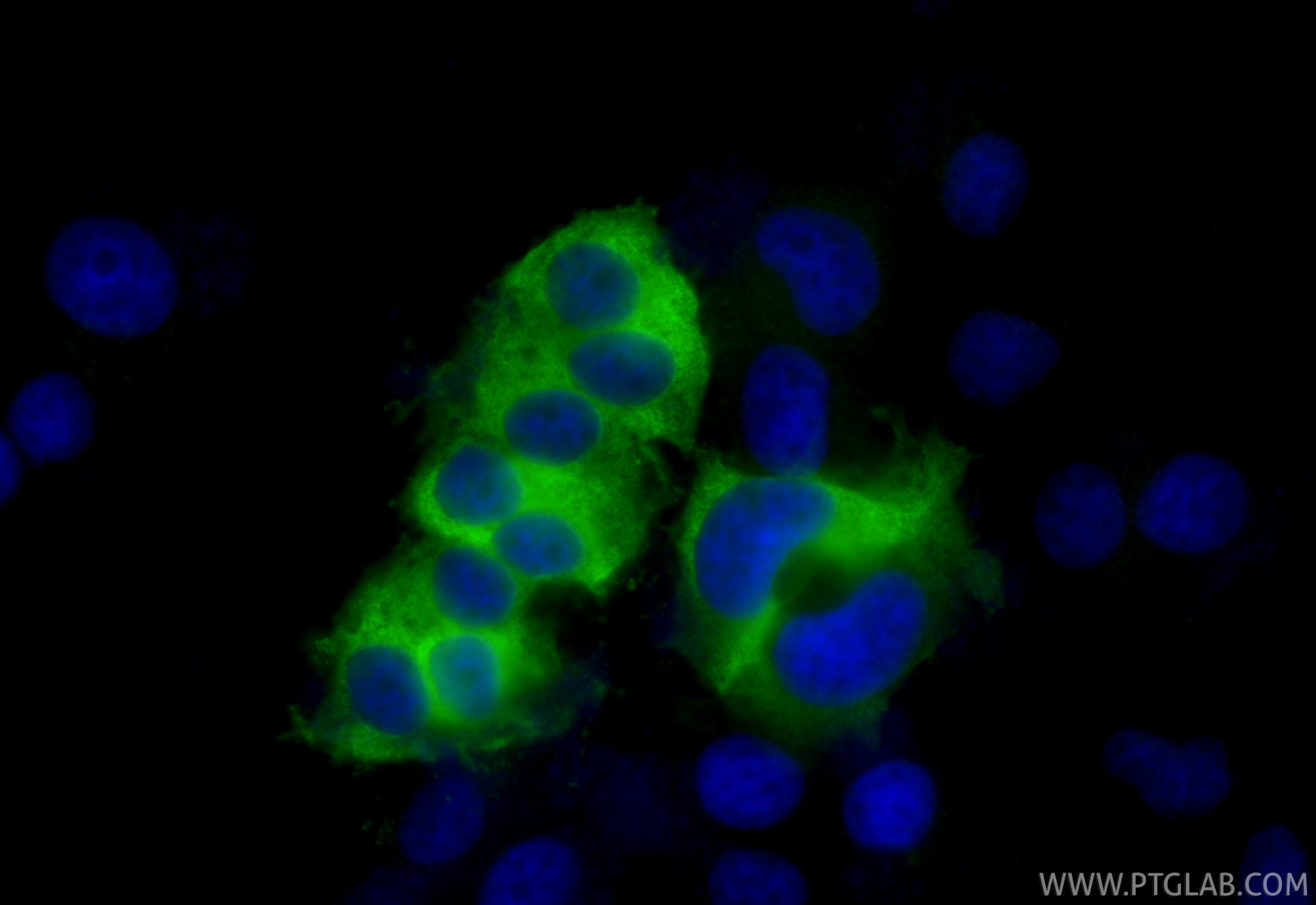 TH antibody (RMX00053) | Proteintech
