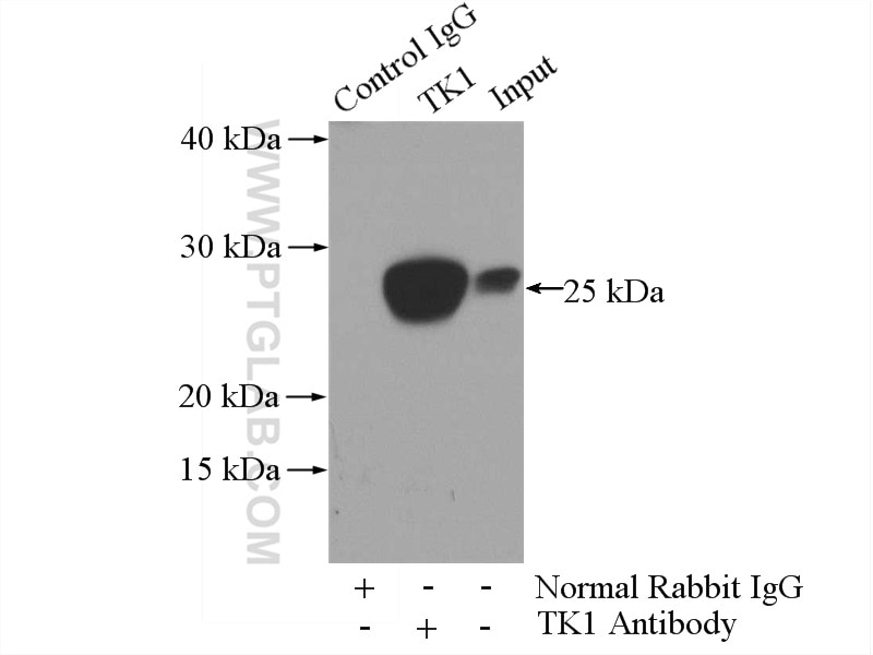 TK1 antibody (15691-1-AP) | Proteintech