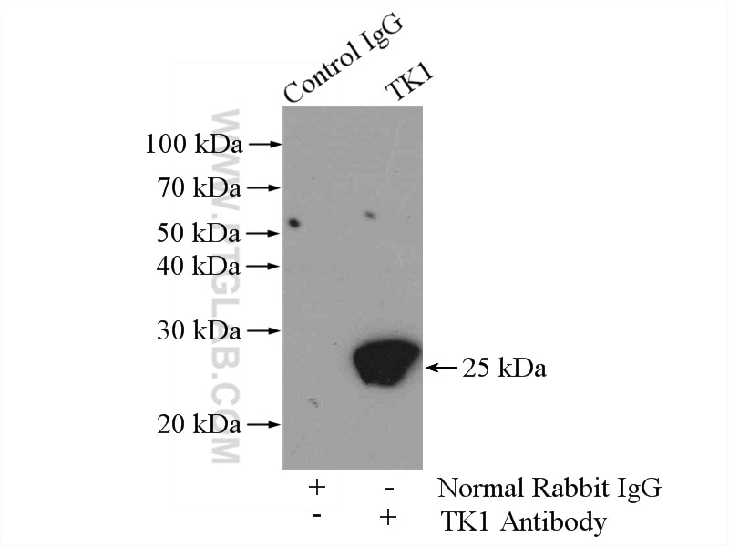 TK1 Fusion Protein Ag8249 | Proteintech