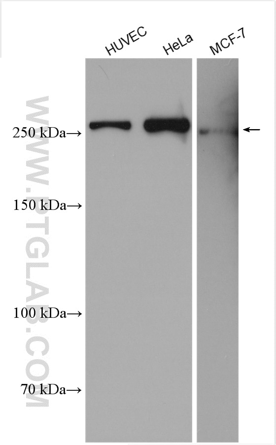 Talin-1 antibody (14168-1-AP) | Proteintech