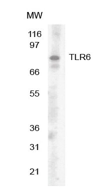 TLR6 antibody (mAb) (Clone 86B1153) | Proteintech