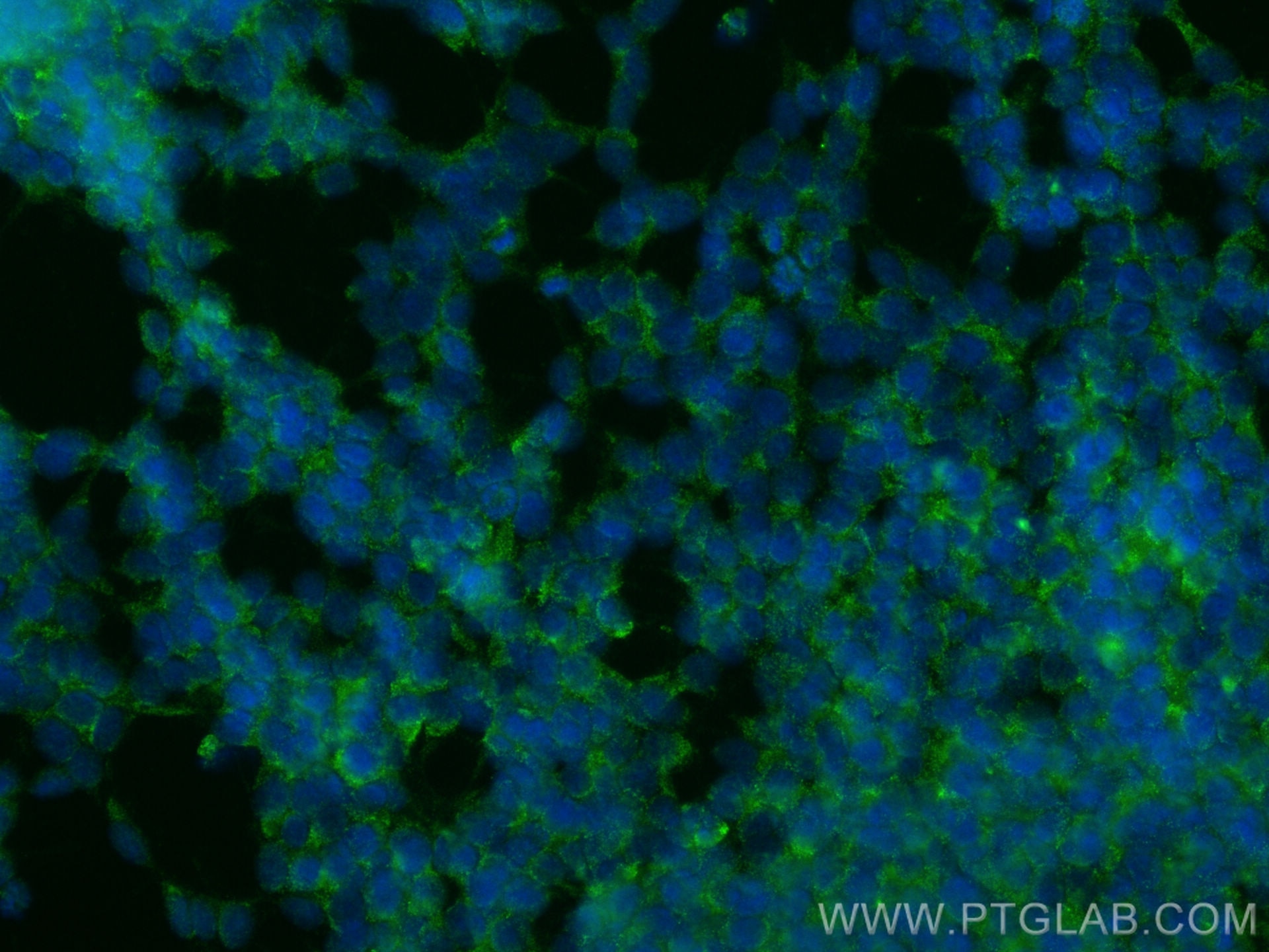 TMEM151A antibody (31640-1-AP) | Proteintech