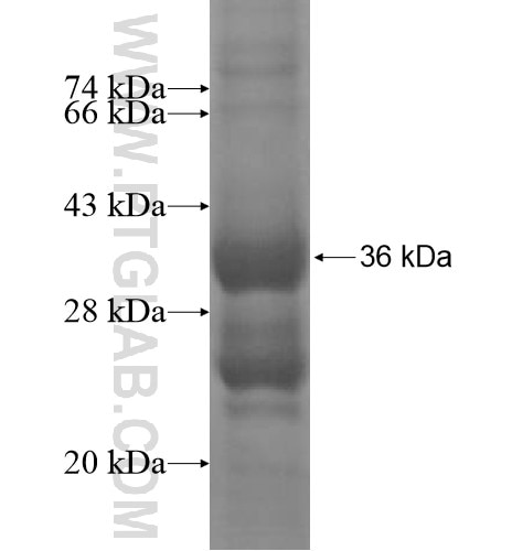 TMEM63A Fusion Protein Ag15362 | Proteintech