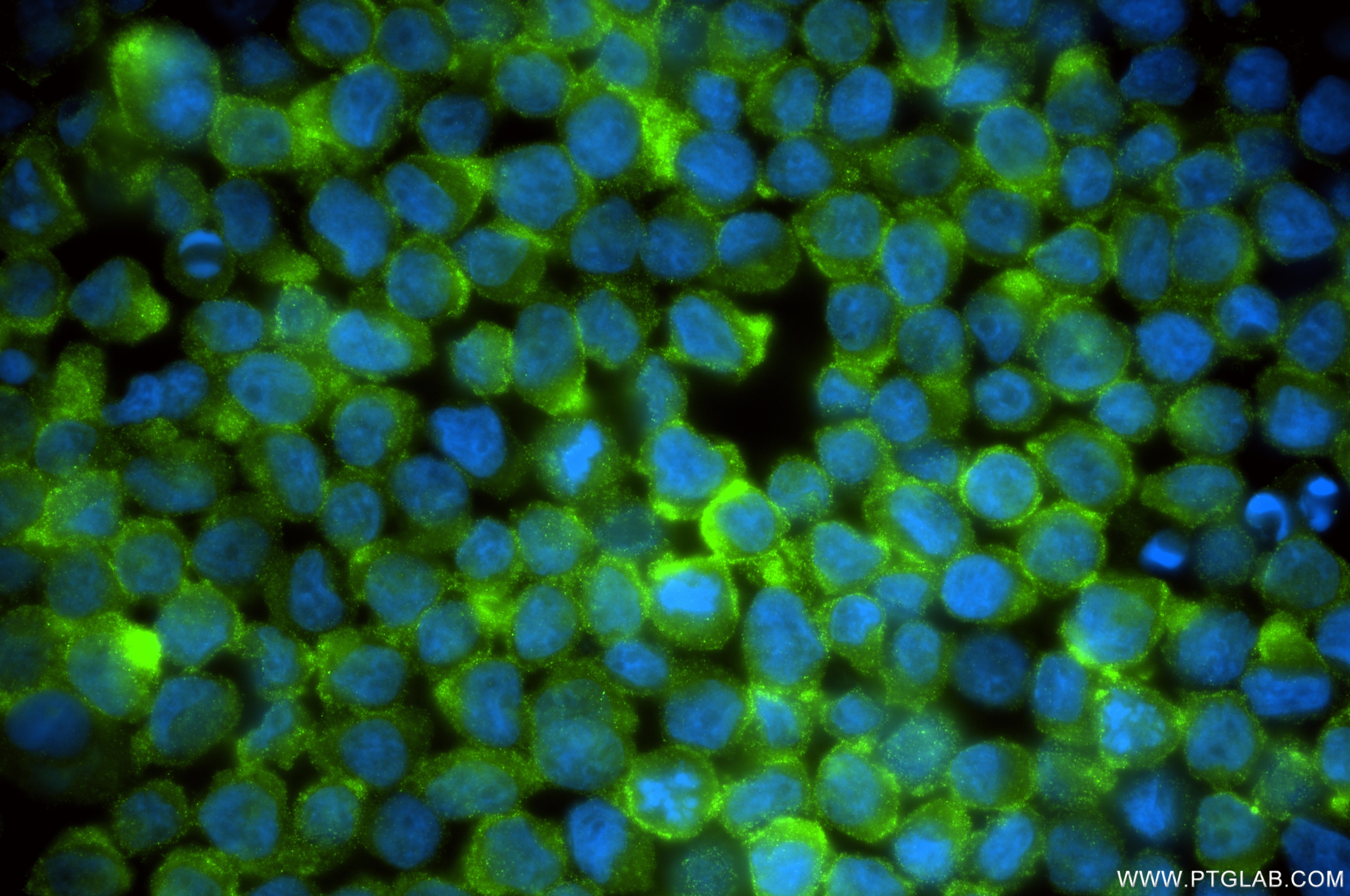 TNFSF11/RANKL antibody (85321-2-PBS) | Proteintech