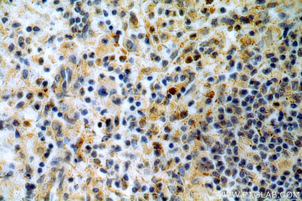 TNFSF13B Fusion Protein Ag2440 | Proteintech