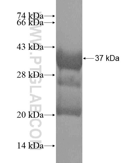 TNKS2 Fusion Protein Ag18948 | Proteintech