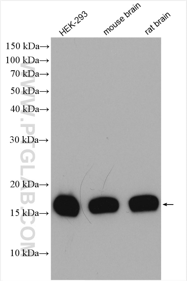 TOM20 Antibody 11802-1-AP | Proteintech
