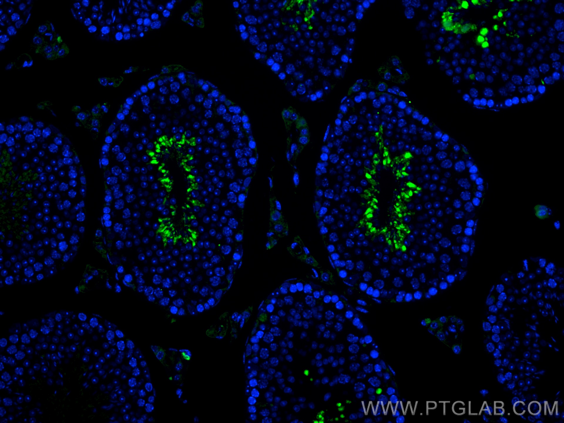 TOMM20L antibody (25496-1-AP) | Proteintech