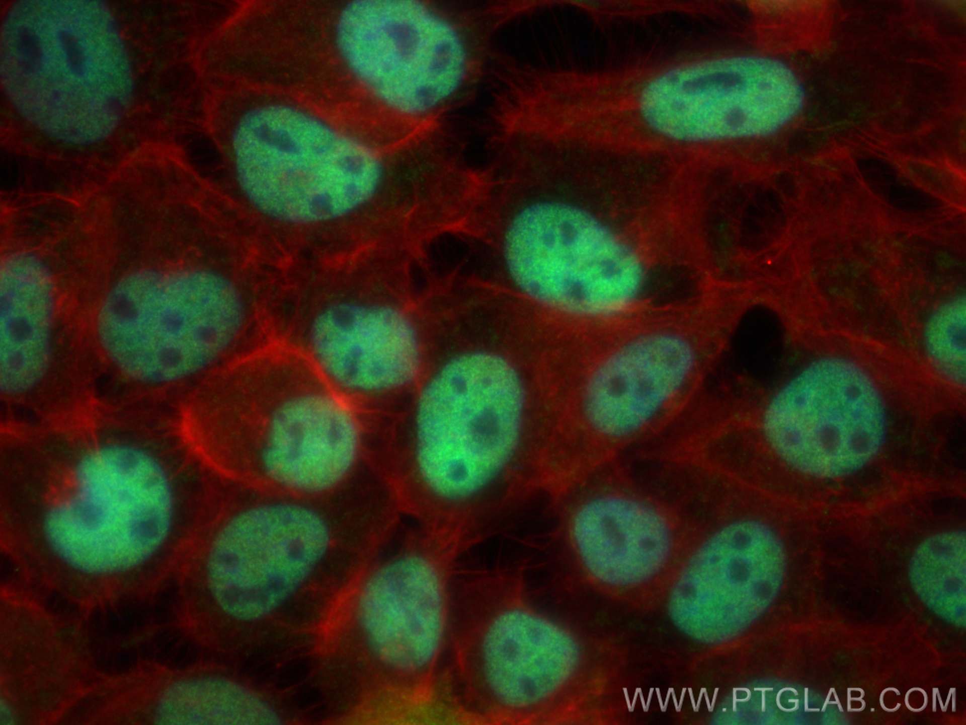 p63 antibody (12143-1-AP) | Proteintech