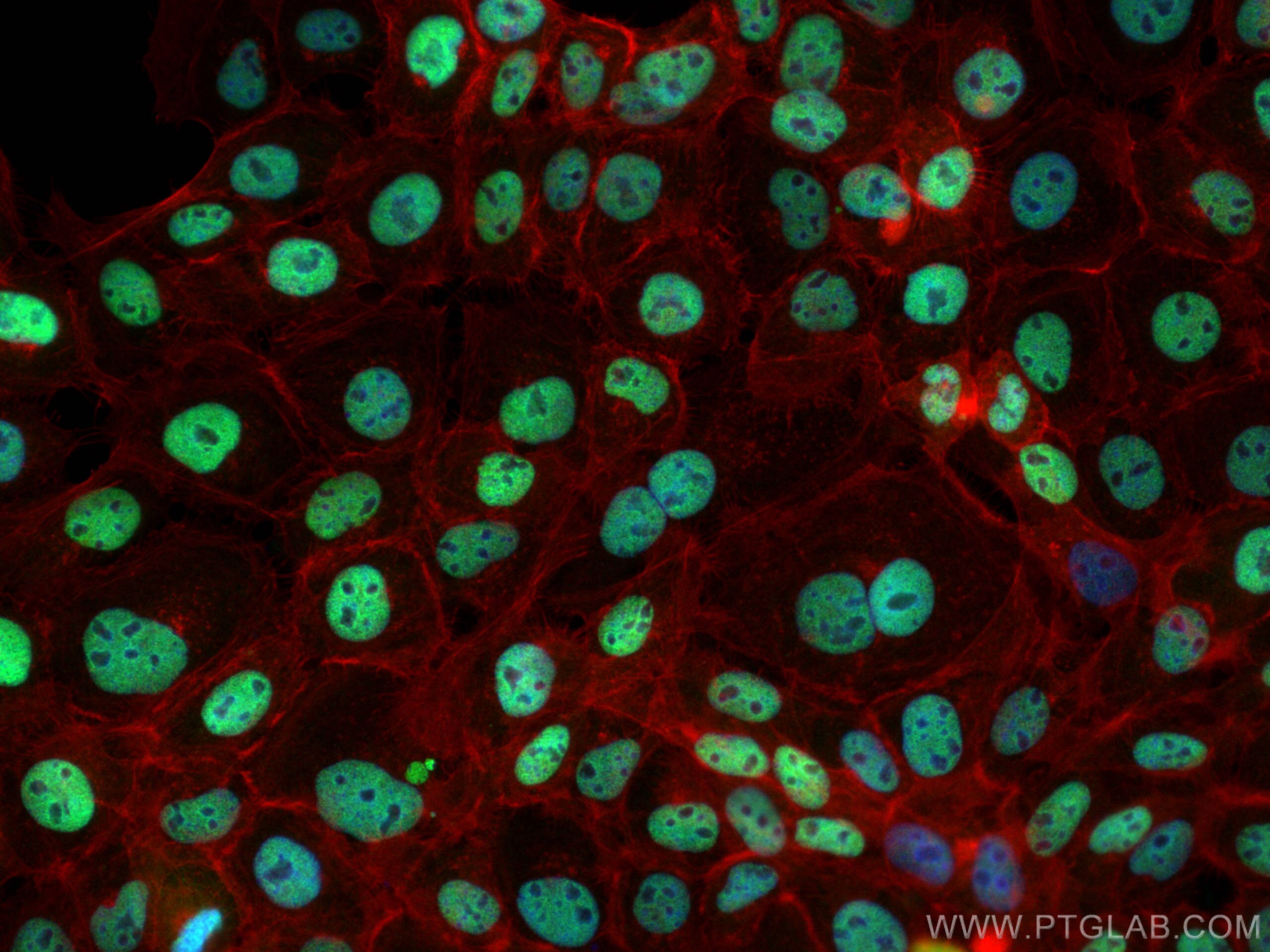 p63 antibody (12143-1-AP) | Proteintech