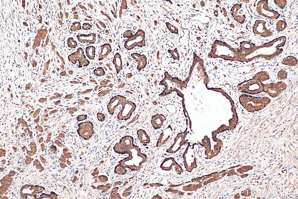 p63 antibody (12143-1-AP) | Proteintech