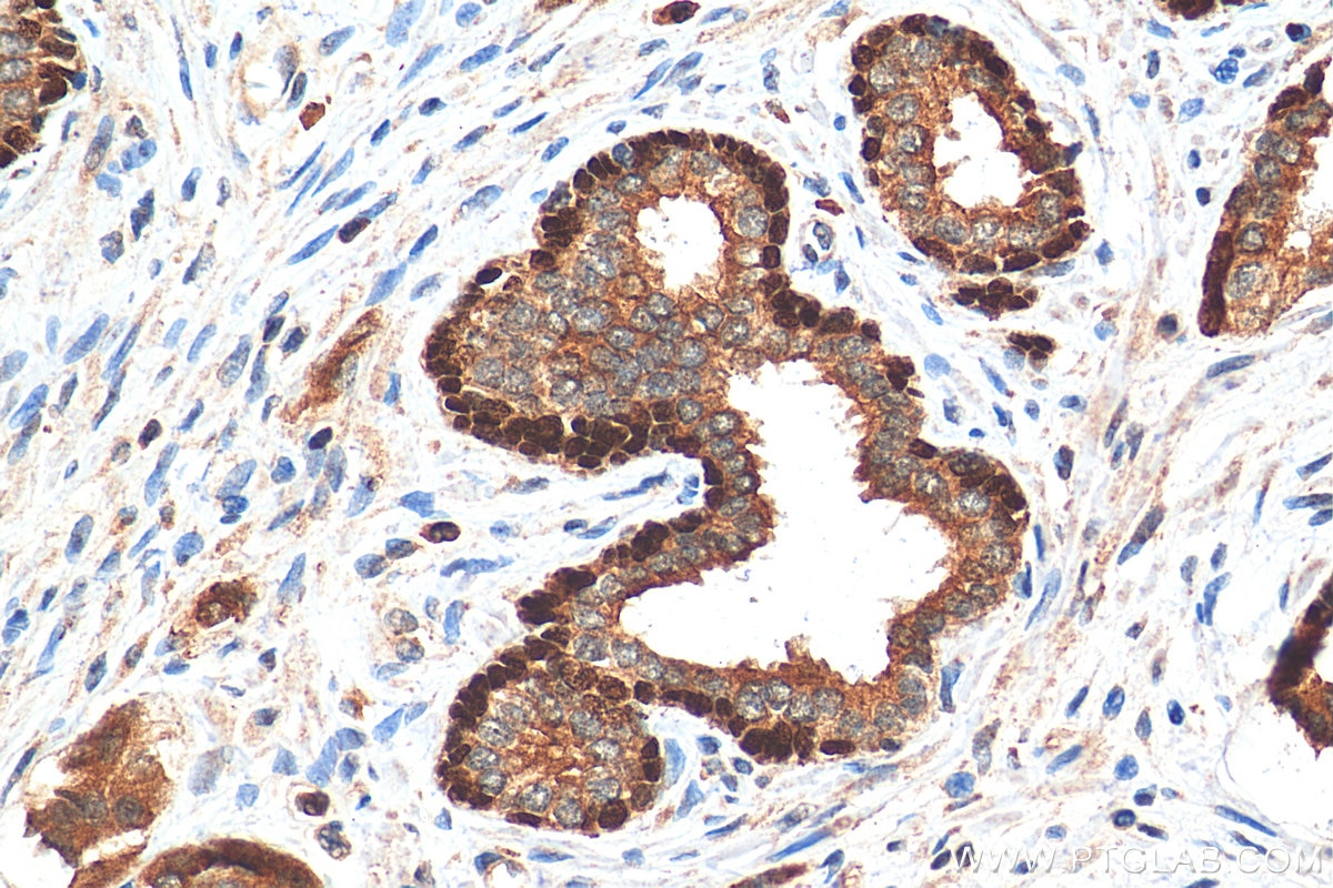 p63 antibody (12143-1-AP) | Proteintech