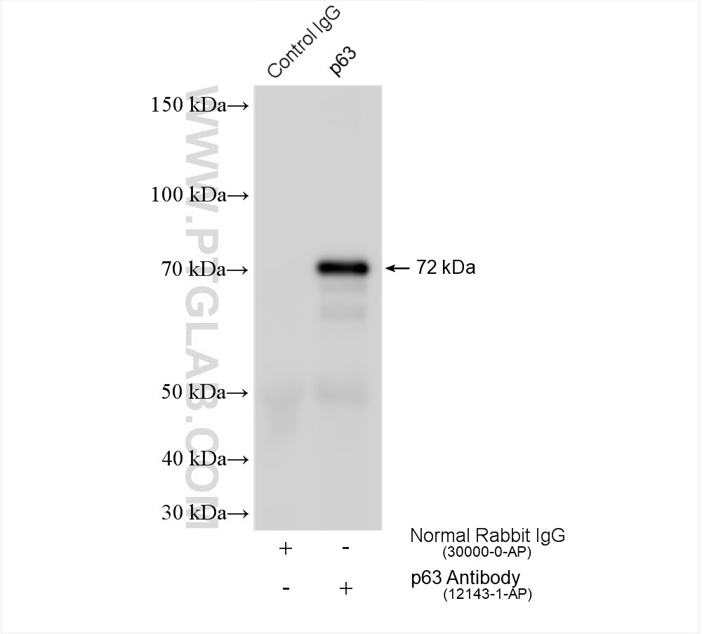 p63 antibody (12143-1-AP) | Proteintech