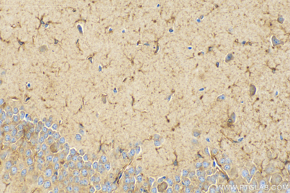 TREM2 antibody (68723-1-Ig) | Proteintech