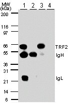 TRF2 antibody (pAb) | Proteintech