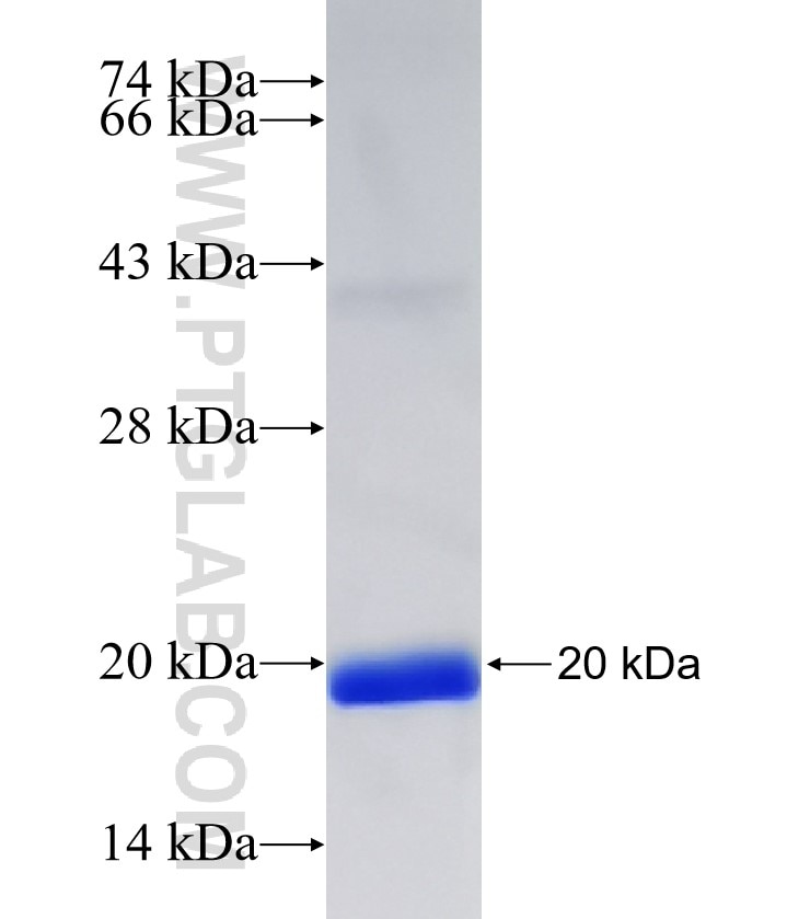 TRIM27 Fusion Protein Ag30592 | Proteintech