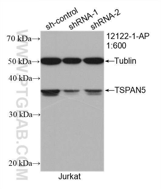 TSPAN5 Fusion Protein Ag2765 | Proteintech