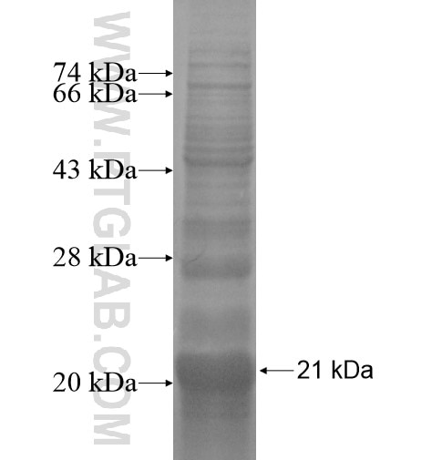 TSPAN5 Fusion Protein Ag14485 | Proteintech
