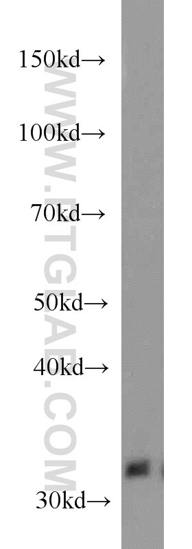 TST Fusion Protein Ag9235 | Proteintech