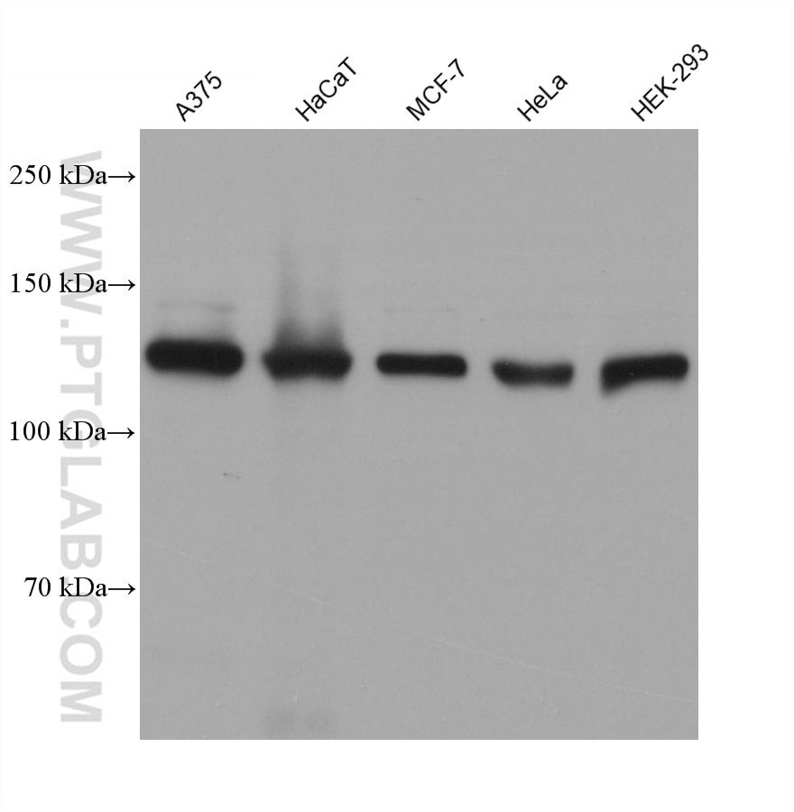 TTF1-Specific antibody (60235-2-Ig) | Proteintech