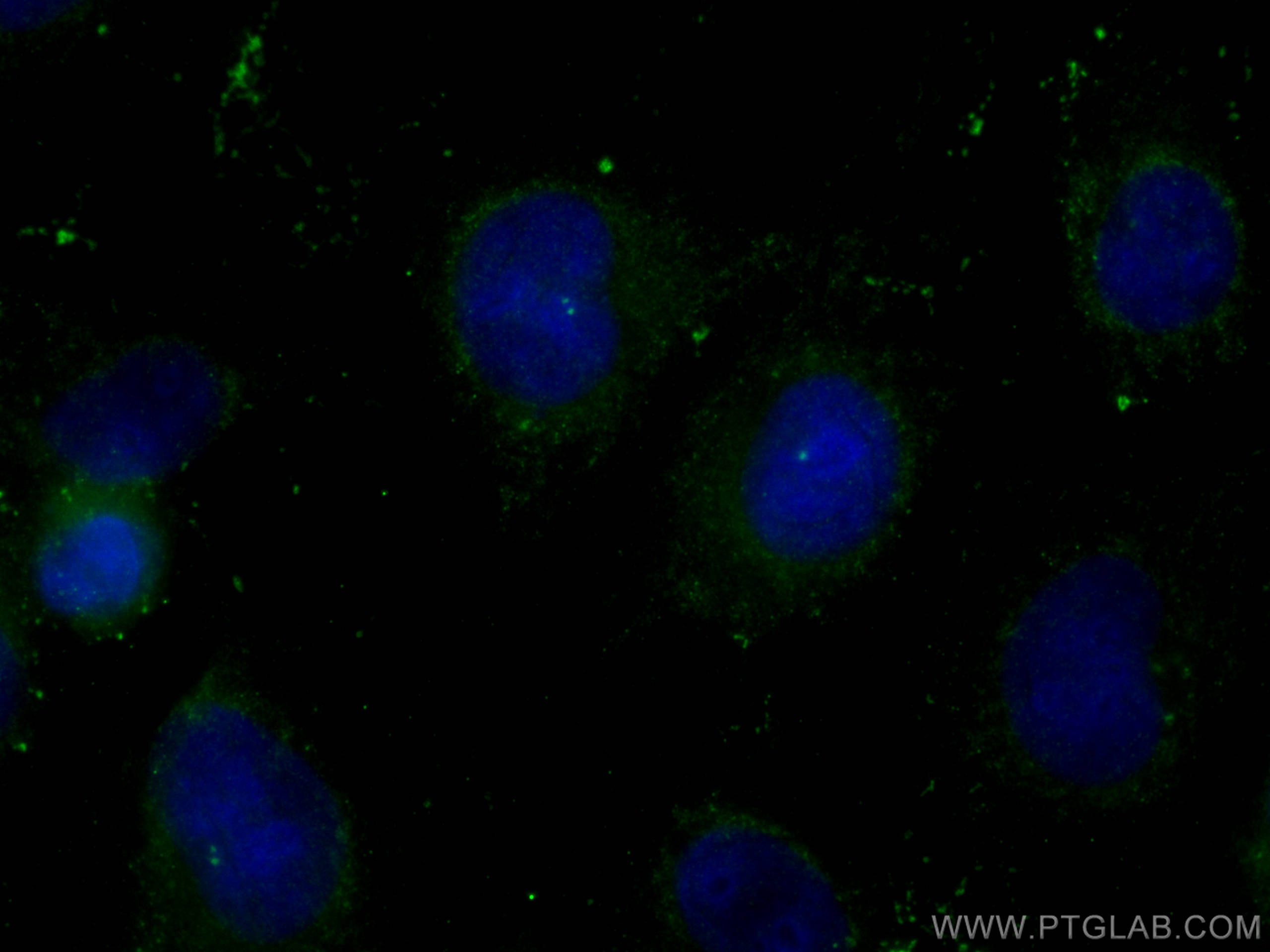 Gamma Tubulin antibody (15176-1-AP) | Proteintech