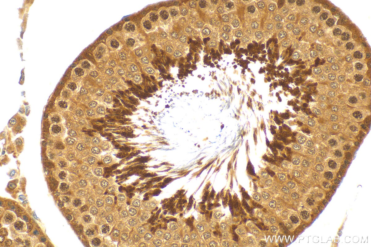 TUSC1 antibody (31410-1-AP) | Proteintech