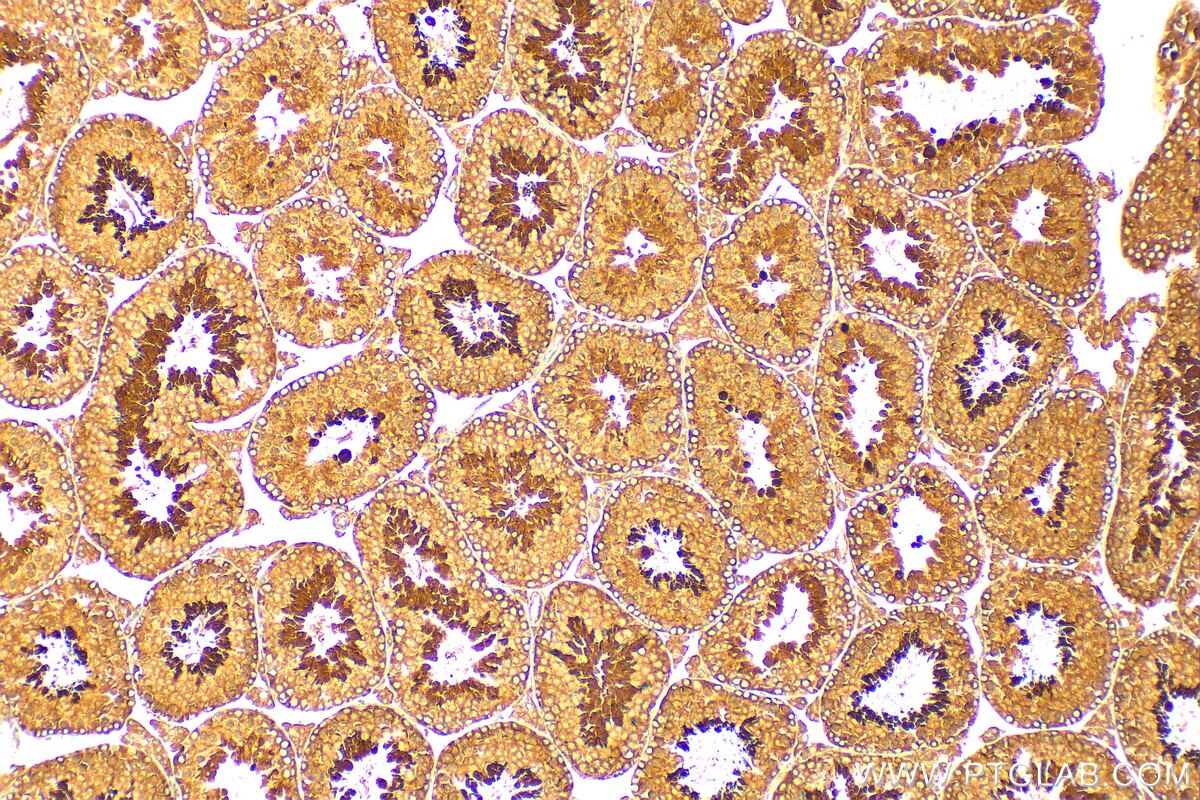 TUSC1 antibody (31410-1-AP) | Proteintech