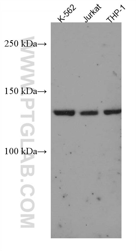 TYK2 Fusion Protein Ag9462 | Proteintech