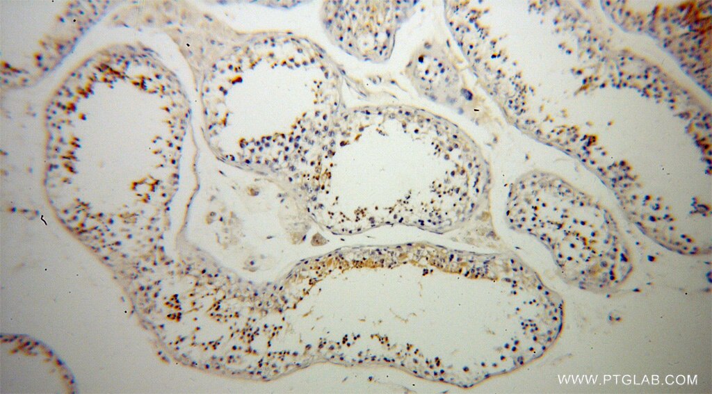 UBQLN3 antibody (13568-1-AP) | Proteintech
