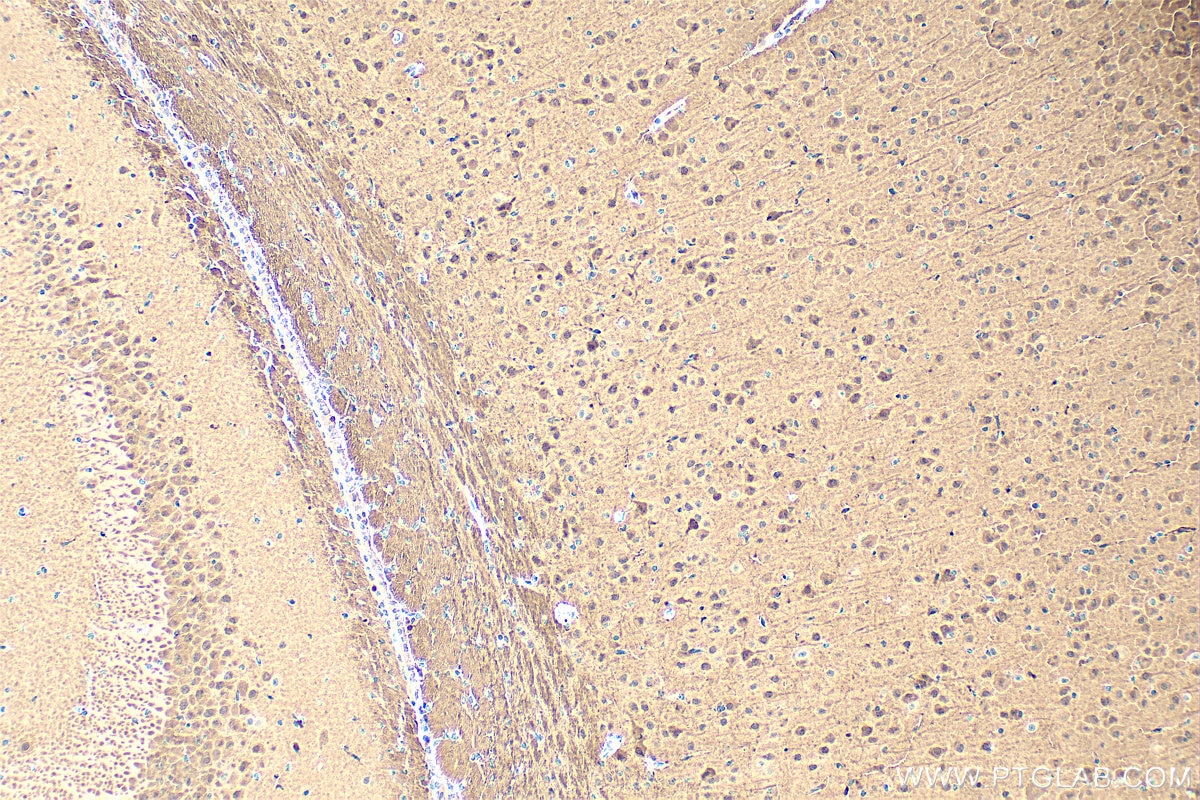 UCH-L1/PGP9.5 antibody (RMX00043) | Proteintech