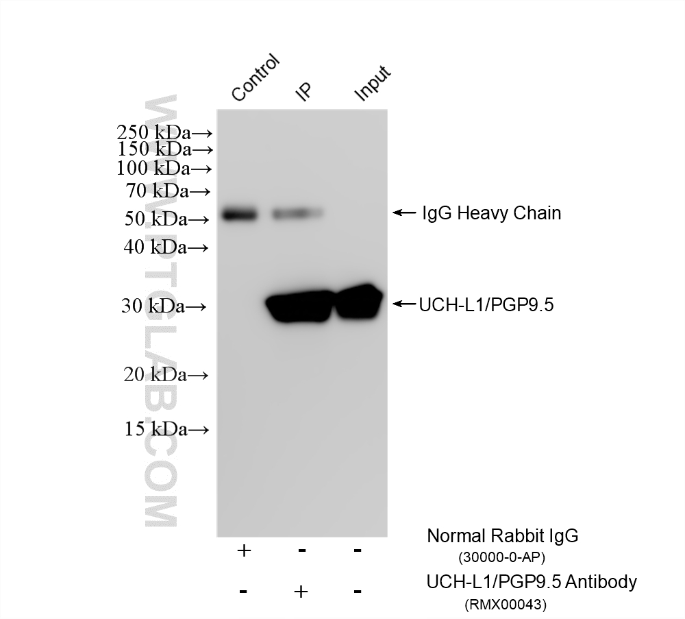 UCH-L1/PGP9.5 antibody (RMX00043) | Proteintech
