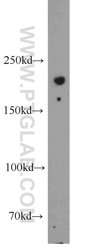 UNC13A/Munc13-1 antibody (55053-1-AP) | Proteintech