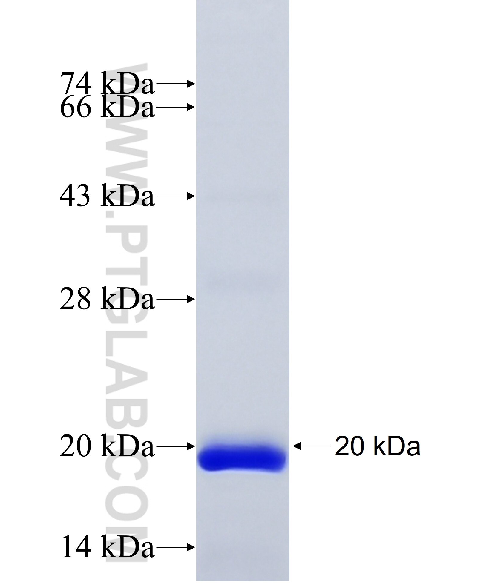 USH2A Fusion Protein Ag31270 | Proteintech