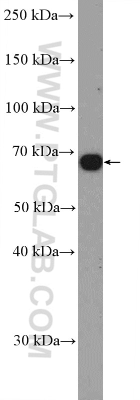 USP30 Fusion Protein Ag7620 | Proteintech