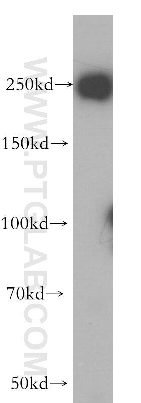 USP32 antibody (18838-1-AP) | Proteintech