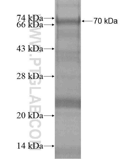 USP35 Fusion Protein Ag18730 | Proteintech