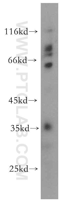 USP46 Fusion Protein Ag4330 | Proteintech