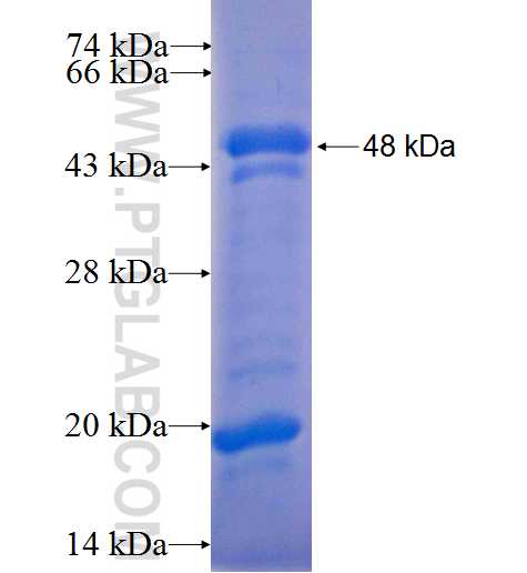 USP46 Fusion Protein Ag5607 | Proteintech