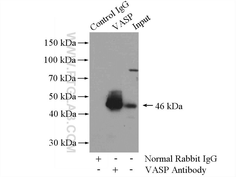 VASP antibody (13472-1-AP) | Proteintech