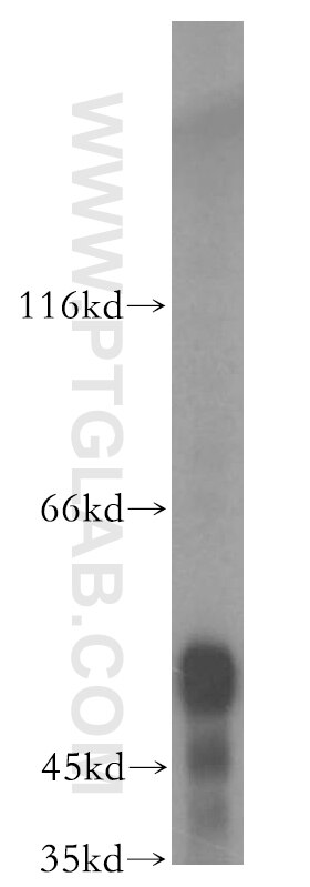 VDBP,GC Fusion Protein Ag10286 | Proteintech