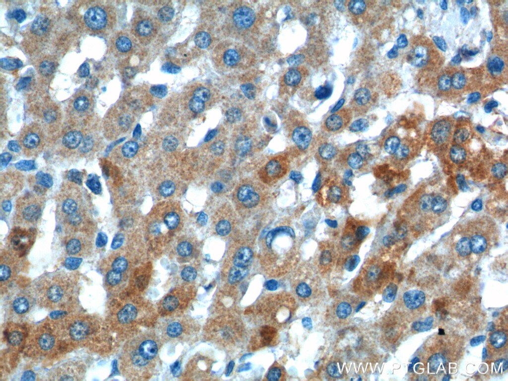 VPS13B antibody (24505-1-AP) | Proteintech