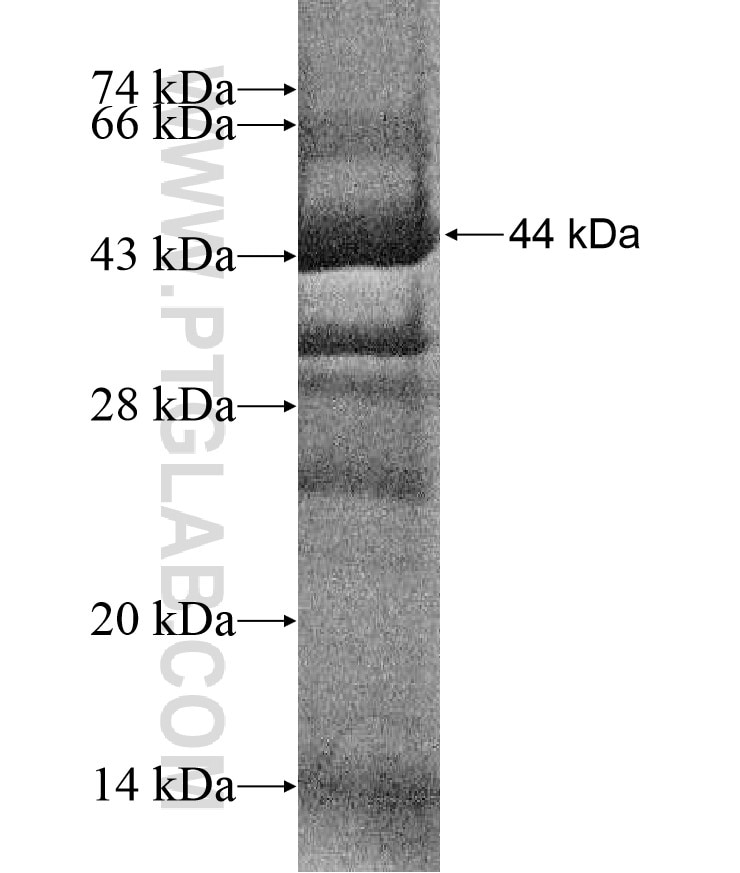 VPS52 Fusion Protein Ag17611 | Proteintech